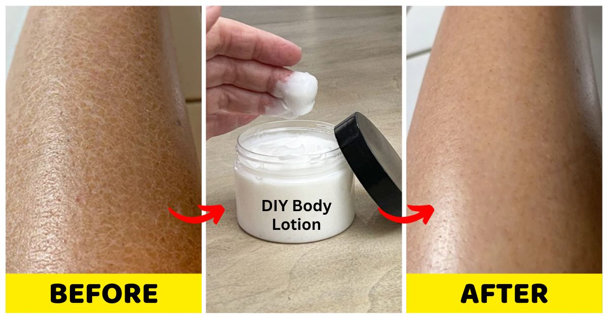 The Best DIY Lotion To Keep Your Skin Moisturized All Winter - Woman ...