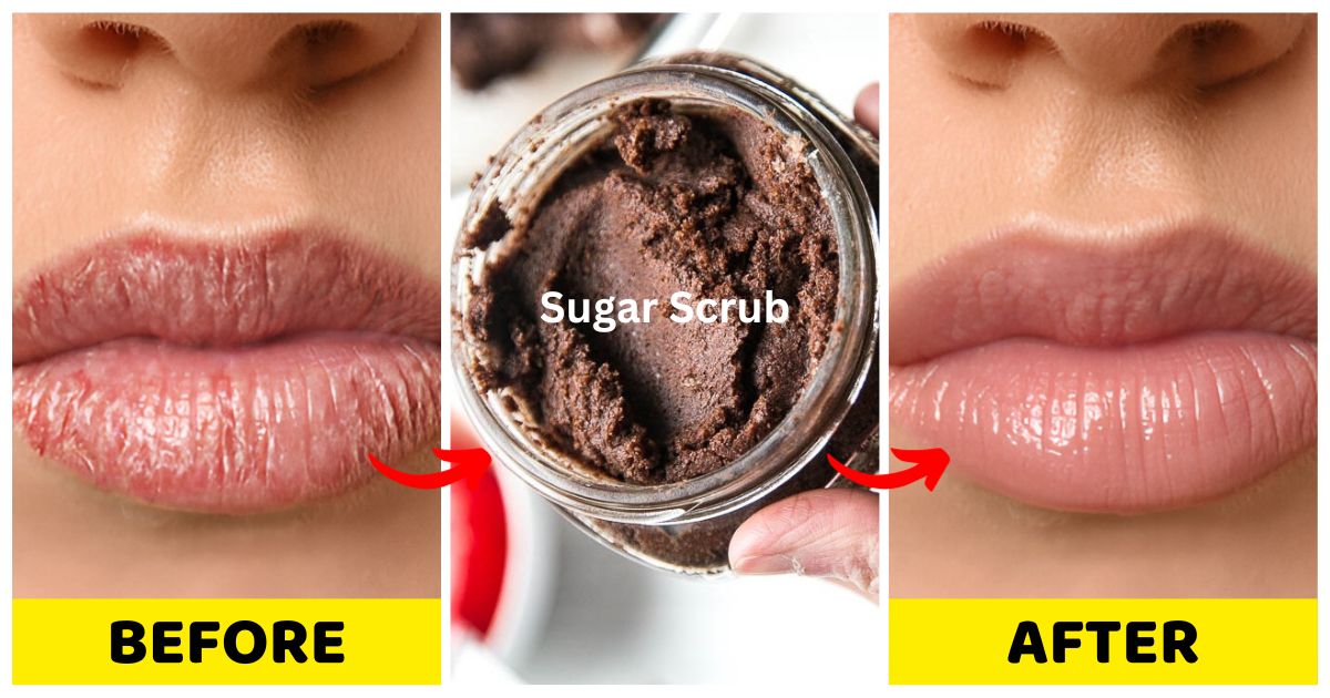 10 DIY Sugar Scrubs To Make Your Skin As Smooth As A Baby’s - Woman ...
