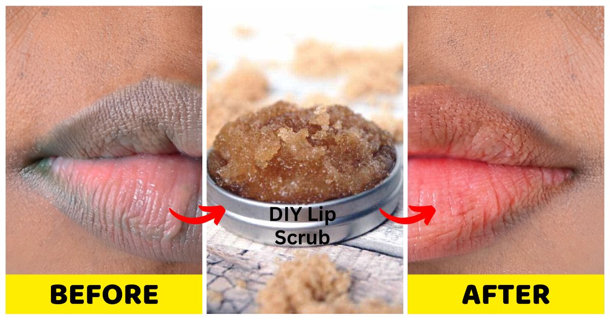 10 DIY Remedies To Lighten Dark Lips To Naturally Pink - Woman & Lifestyle