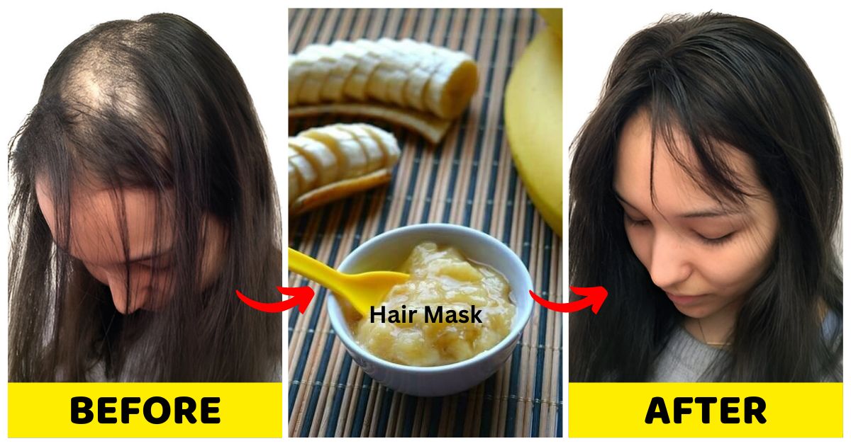 10 Effective DIY Banana Hair Masks To Promote Fast Hair Growth - Woman ...