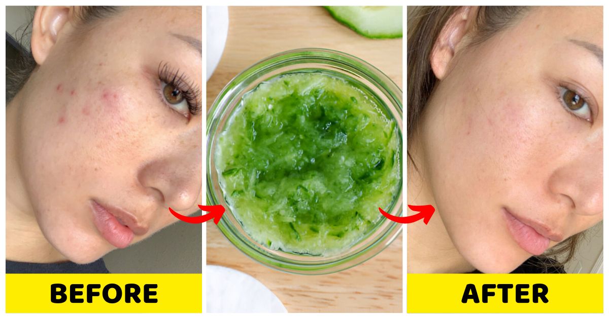 10 Simple DIY Sheet Masks To Make Your Skin Glow And Healthy - Woman ...