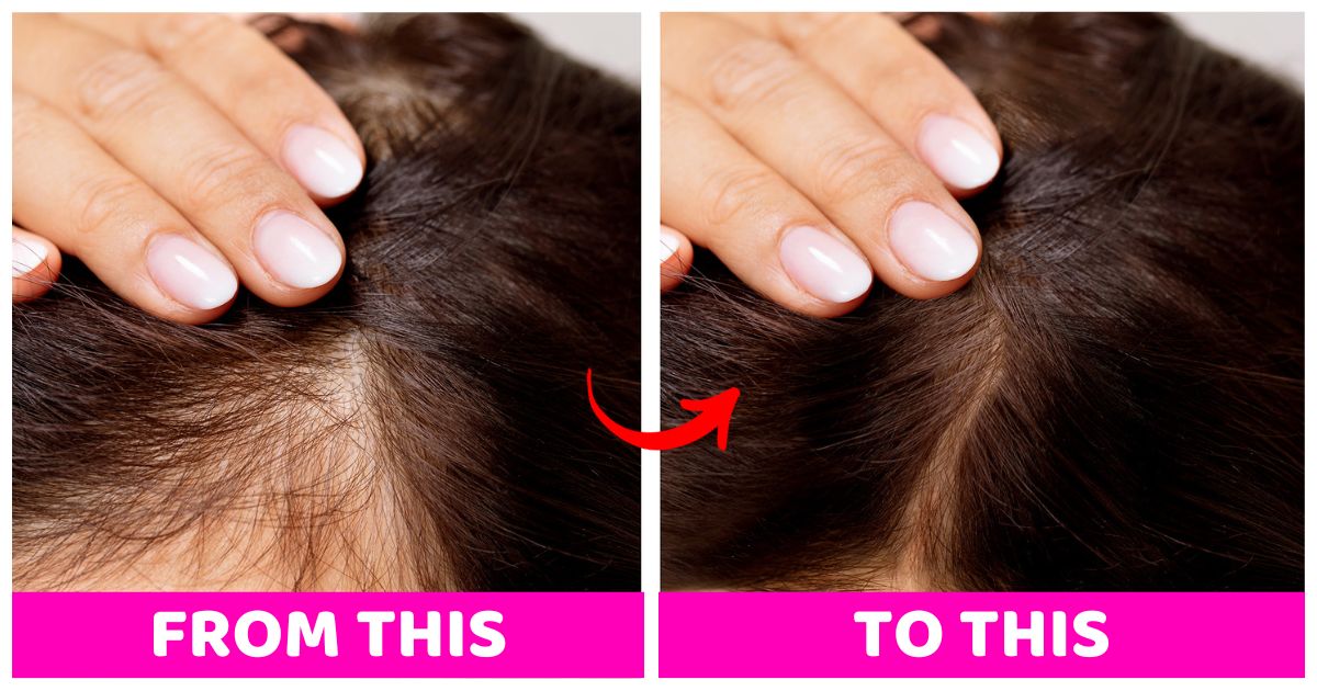 10 Effective Hair Growth Tips That Are Scientifically Proven - Woman ...